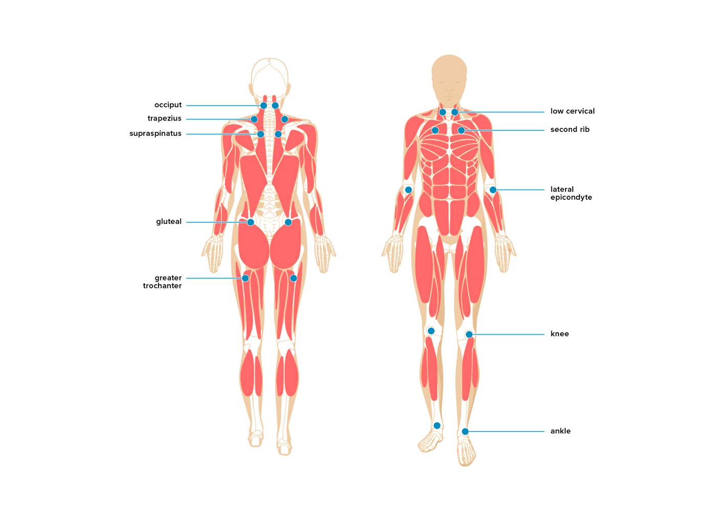 Lifestyle Modifications for Myofascial Pain: Unlocking the Path to Relief